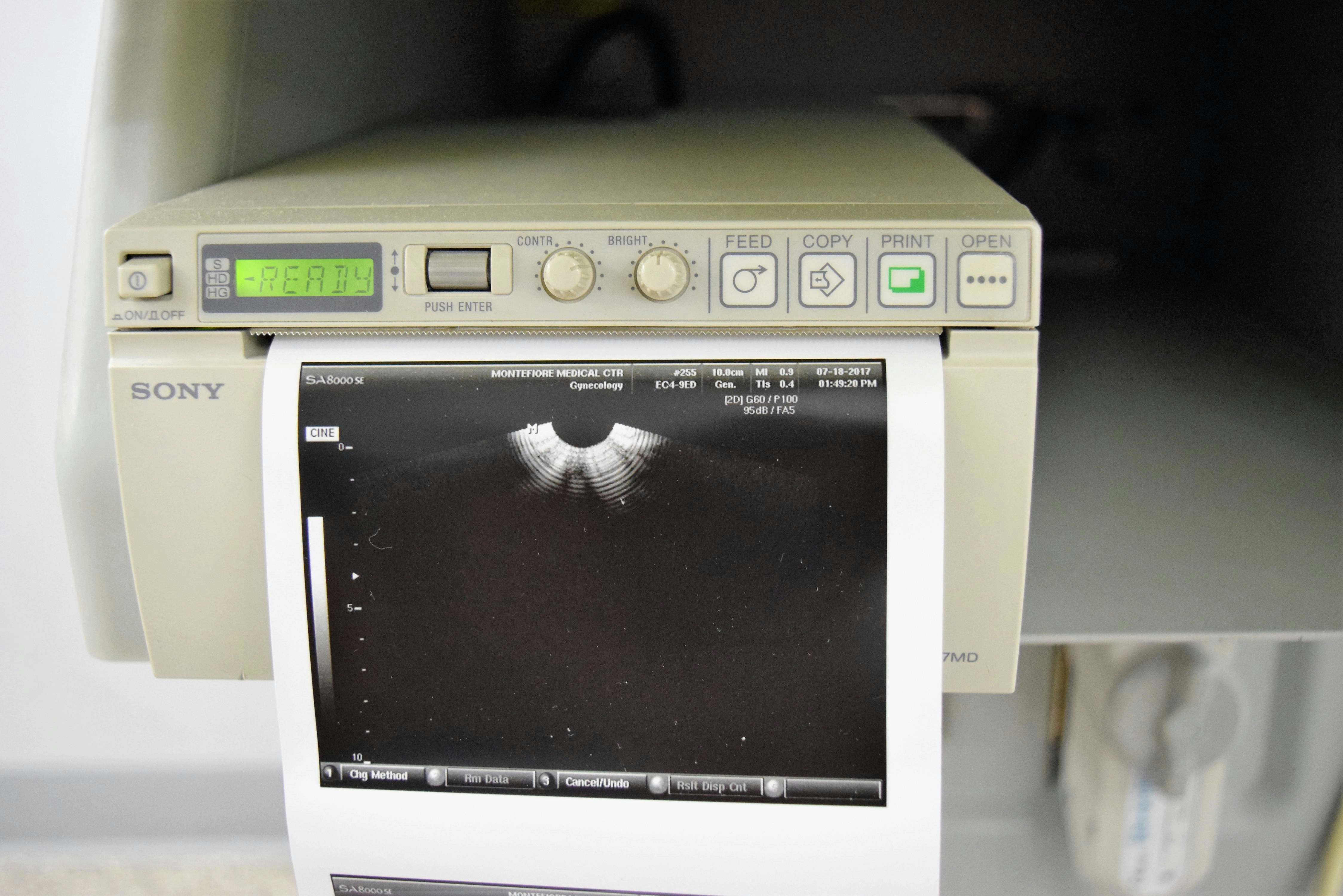 Medison 8000 Se Ob Gyn Ultrasound Sonogram Printer Vaginal Probe Ec4 9